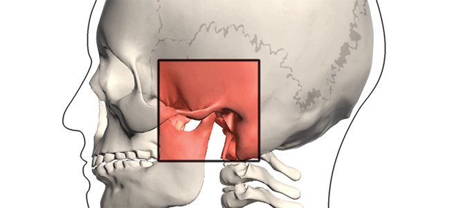 Can You Use a TENS Unit for TMJ?
